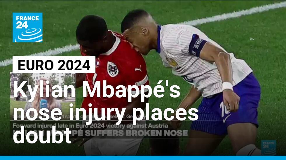 Kylian Mbappé's nose injury places doubt on his continued involvement in Euro 2024 - France 24